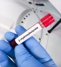 Beta-hydroxbutyrate - Vidan Diagnostics